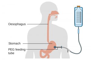 Services – GI Excellence